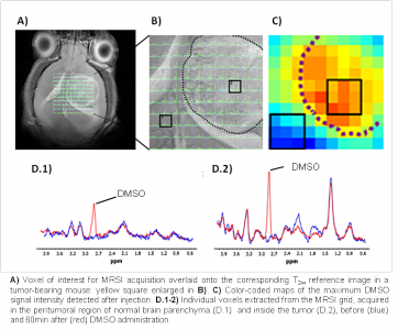 DMSO as a magnetic resonance contrast agent for brain tumors | SeRMN ...